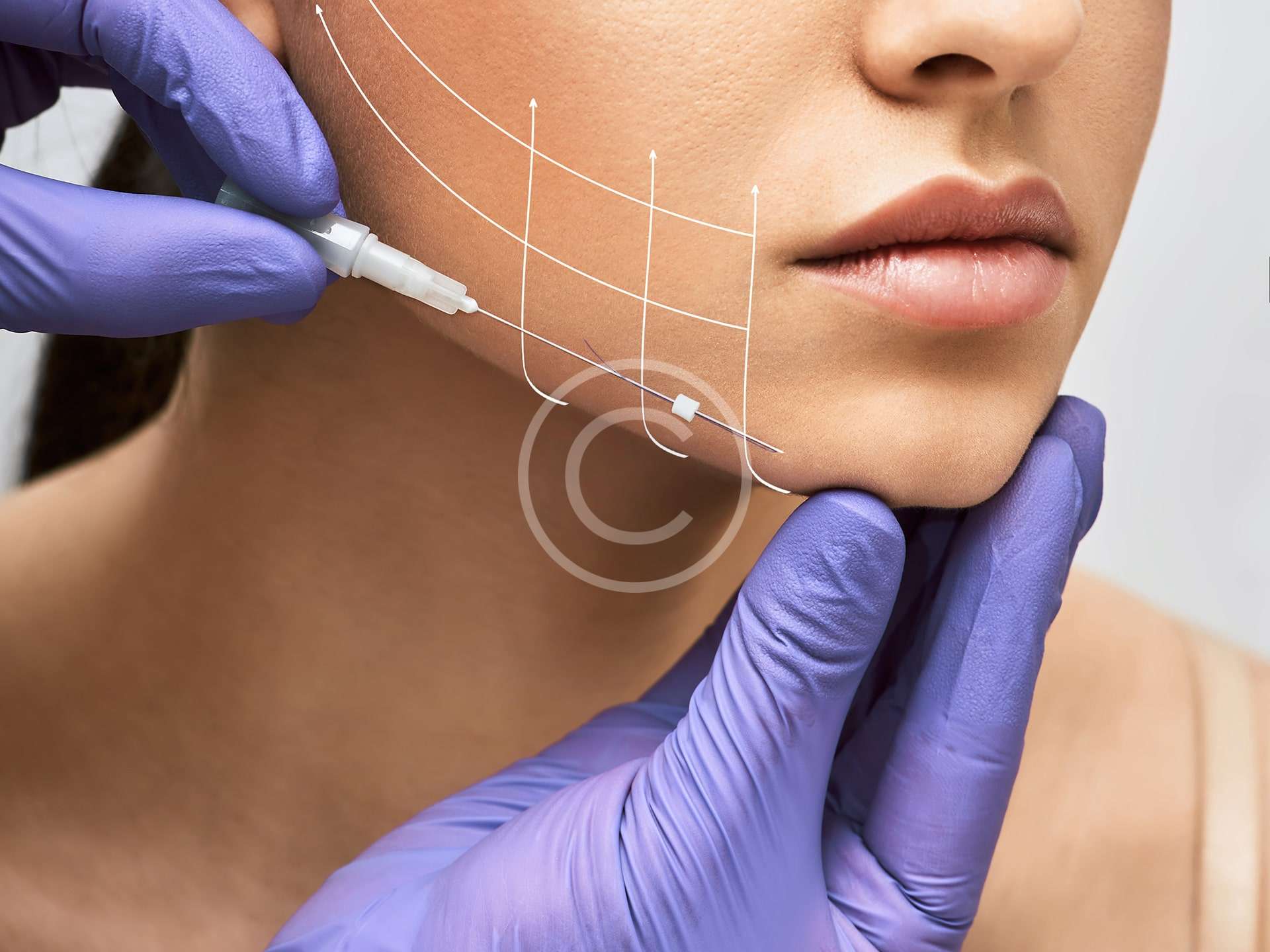 Correcting the lower third of your face with fillers – Mara Clinics