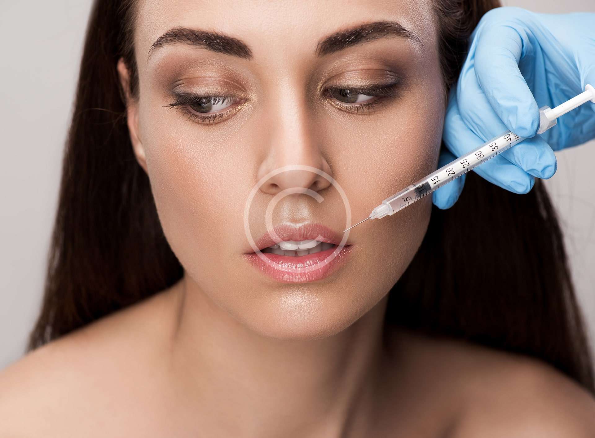 Lip fillers reduce perioral wrinkles caused by stress – Mara Clinics